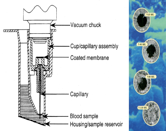 The continued evaluation of the PFA-100 – Machaon Minutes